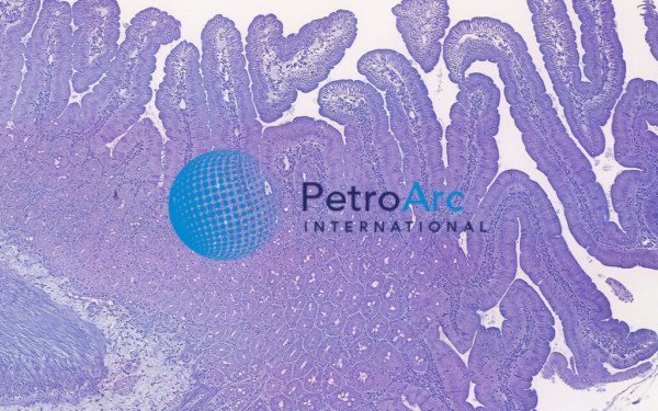 Human Duodenum, Pancreas, 400X TBO, 2um – PetroArc International