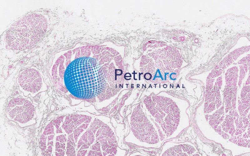 Medullated Nerve, 400X – PetroArc International