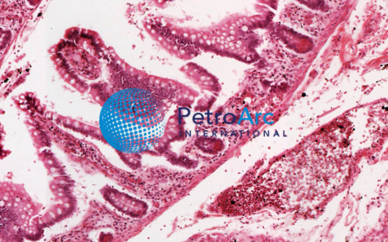 Human Simple Columnar Epithelium, 400X sec – PetroArc International