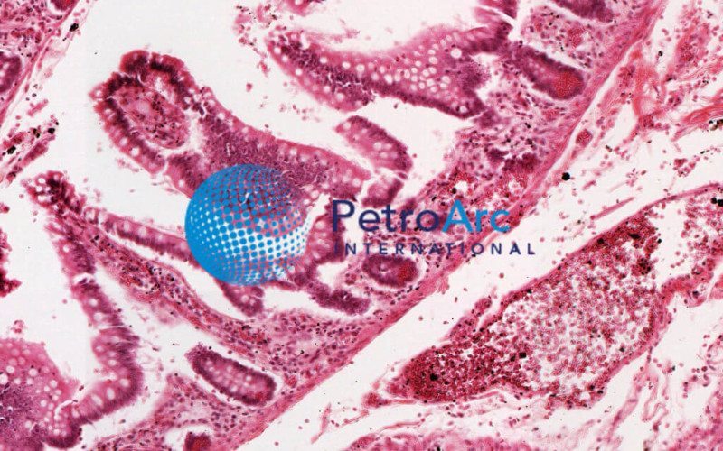 Human Simple Columnar Epithelium, 400X sec – PetroArc International