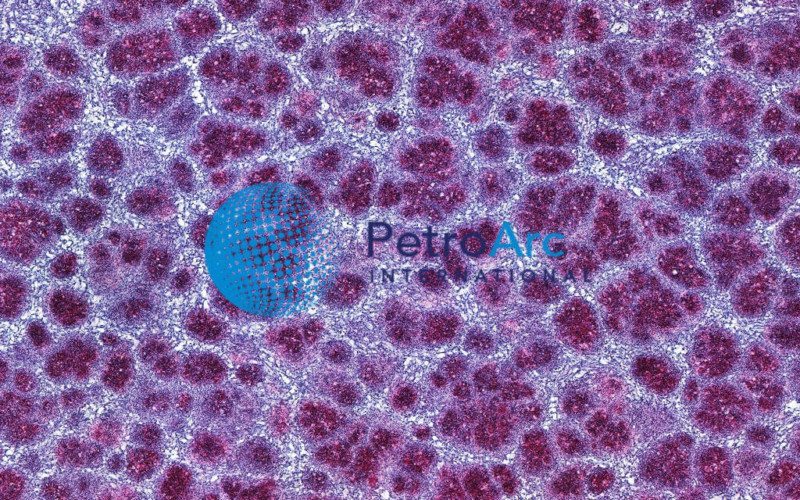 Lycoperdon, 400X l.s. – PetroArc International